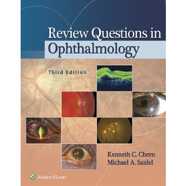 Review Questions in Ophthalmology 3rd Edition | Shopee Philippines