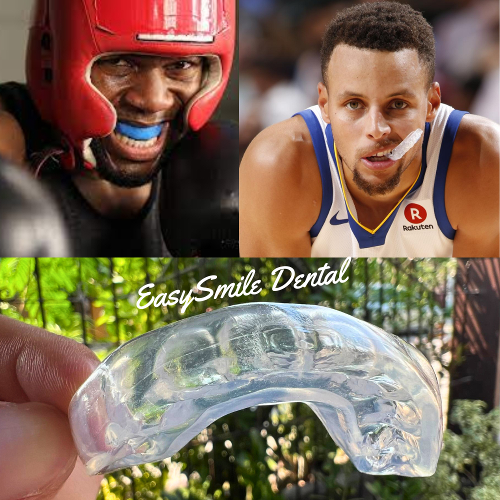 Martial arts Mouth guard | Boxing | MMA | Thai Boxing | Taekwondo ...