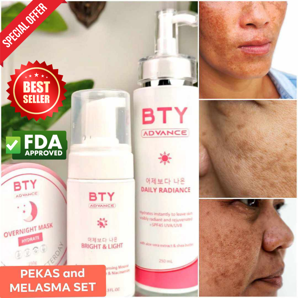 BTY Advance Basic Skincare Set - PEKAS AND MELASMA REMOVER | Shopee Philippines