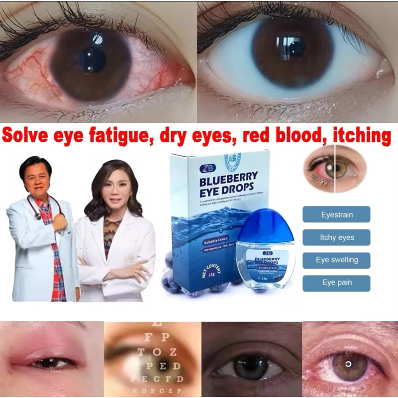Original Blueberries Eye Drops for Red Eye Sore Eyes Blurry Eyes Itchy ...
