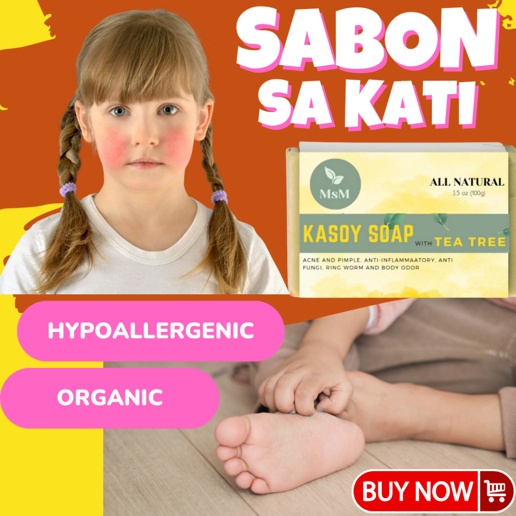 MsM Kids' Sabon sa Kati: Organic Tinea Versicolor & Skin Allergy Relief ...