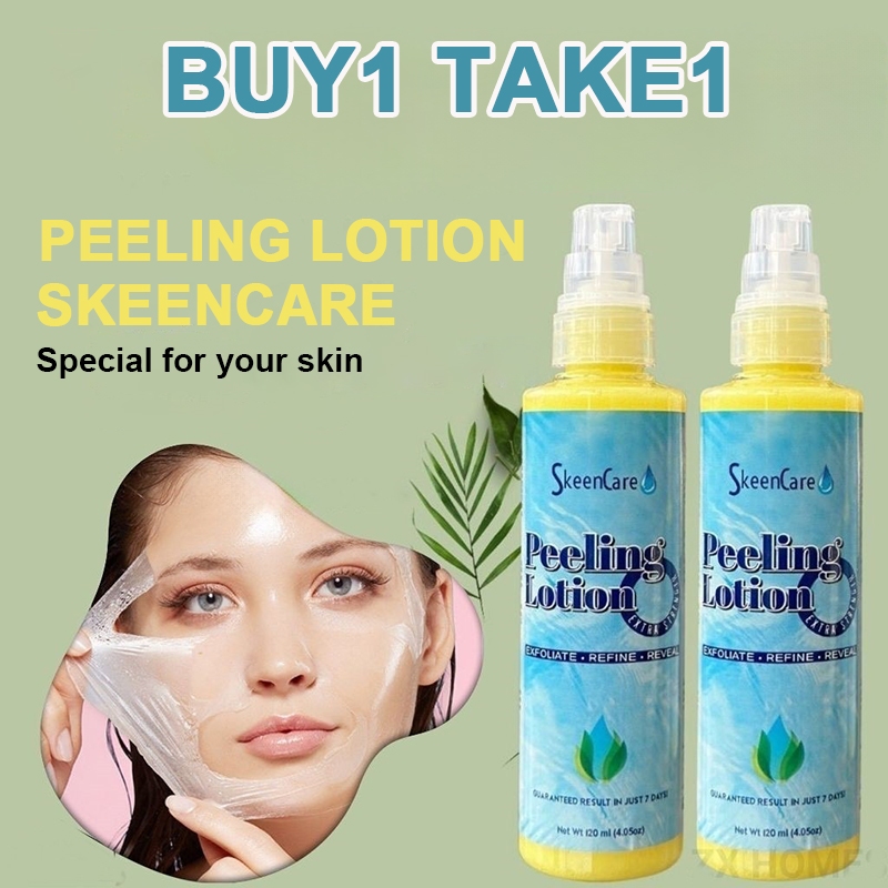 100ml SkeenCare Peeling Lotion Original Skin Renew Dead Whiting skin ...