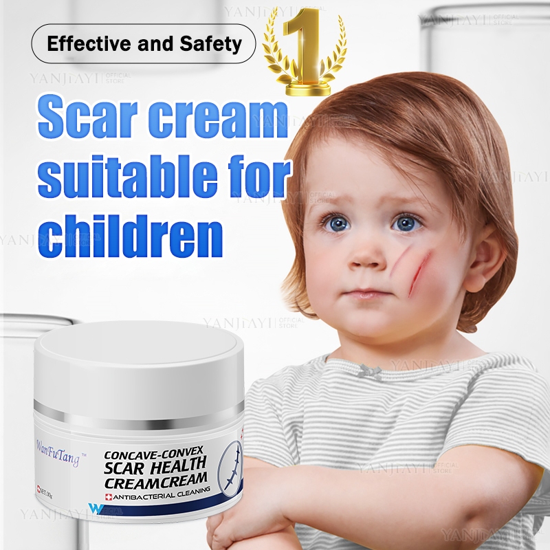 Scar Remover Cream Effective Remove Old Scar Stretch Mark Peklat ...
