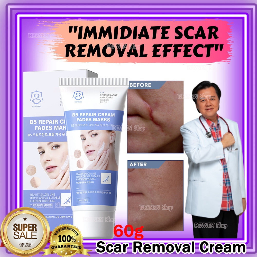 Peklat Removal B5 Scar Remover Cream Repair Old Scar Remove Stretch ...