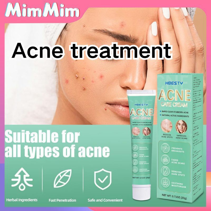 100% Effective Acne Marks Remove Quickly Acne Scars Pimple Remover Acne Cream Fades Acne Essence ...