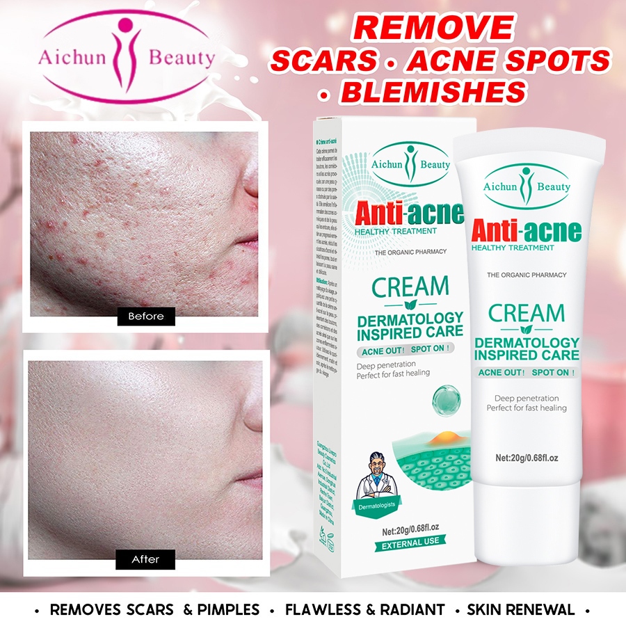 Acne remover cream Pore minimizer Pimple eraser Pimple marks remover ...