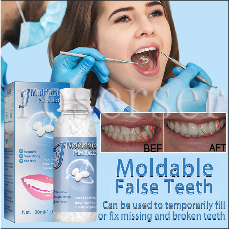 30ML Temporary Tooth Repair Kit Filling Teeth Gaps Moldable False Teeth ...