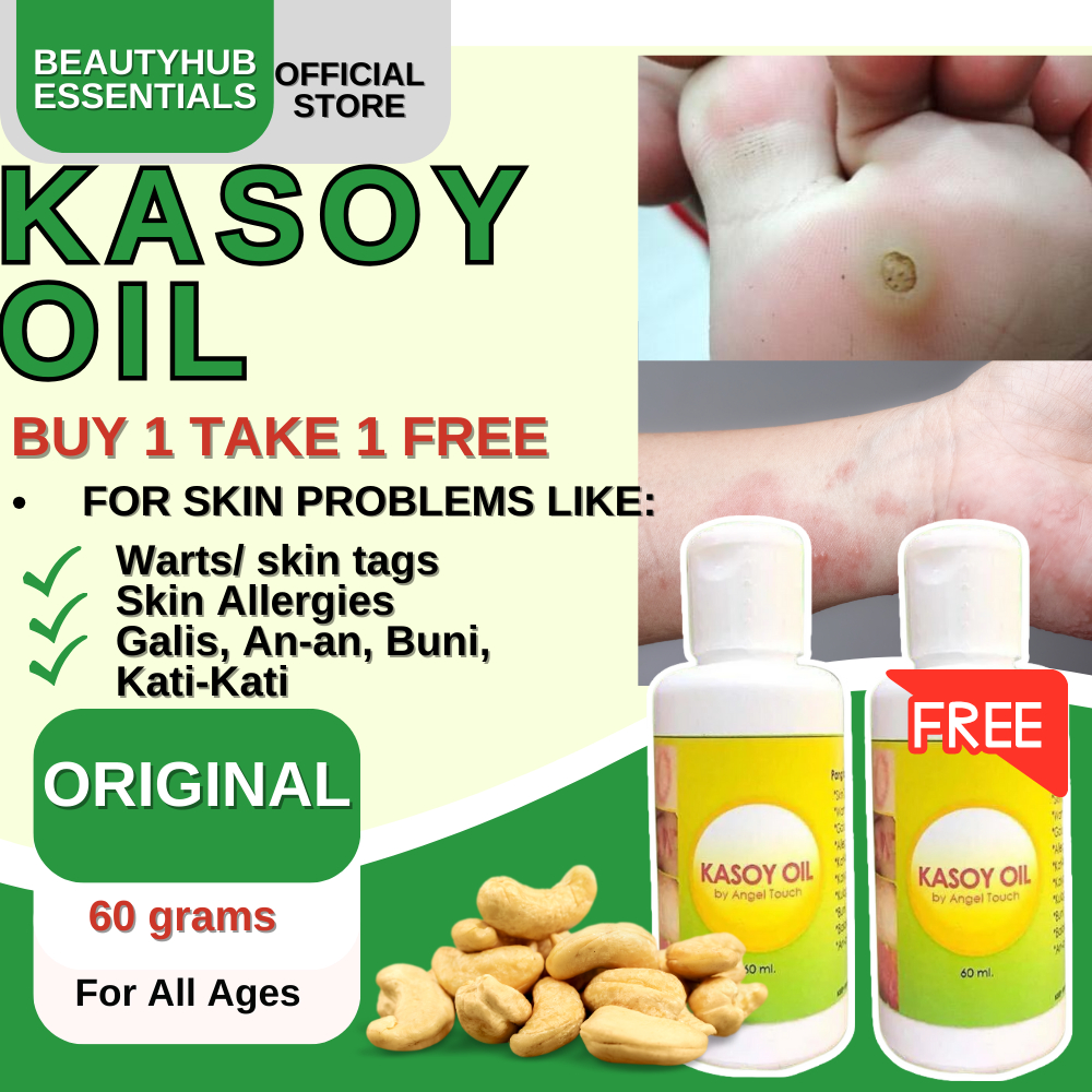 Buy 1 Take 1 Kasoy Oil Kulugo Balakubak Warts Remover Herbal Oil ...