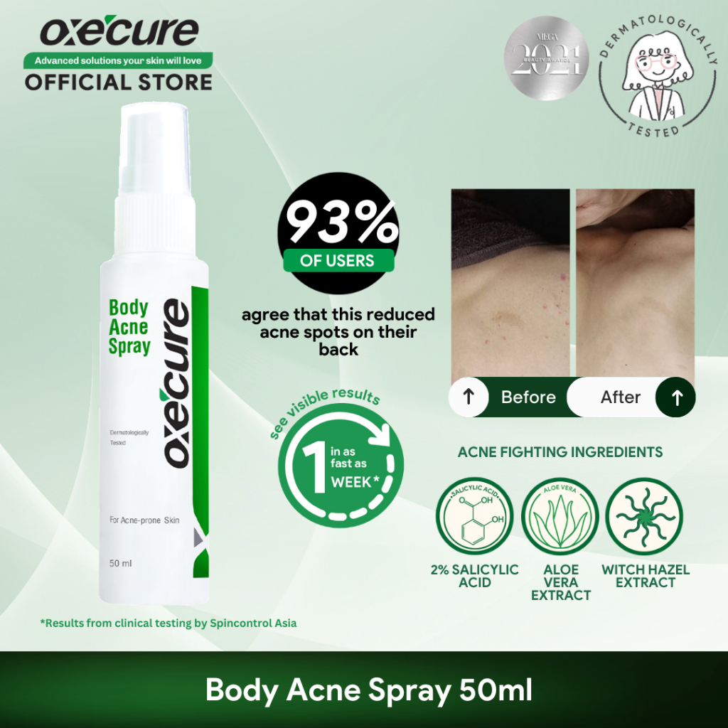 OXECURE 2% Salicylic Acid Body Acne Spray 50ml | Shopee Philippines