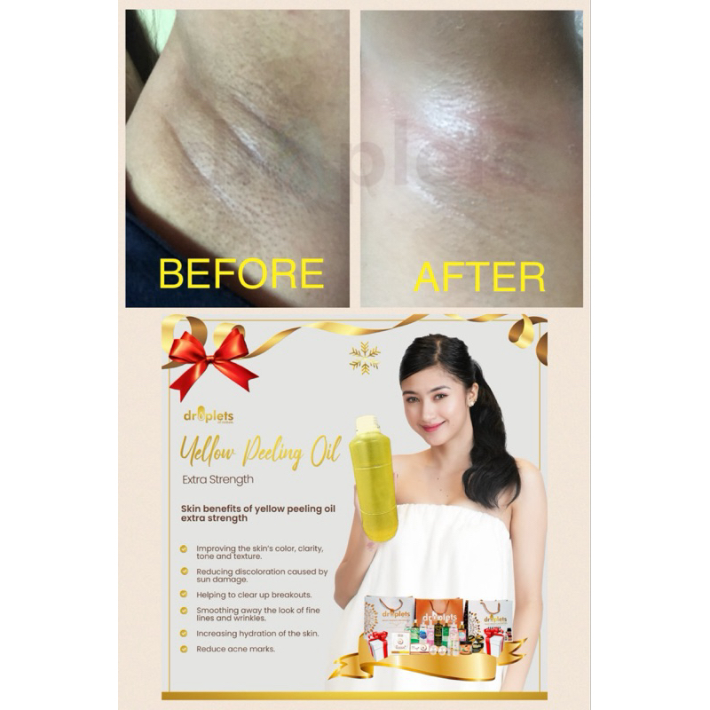 DON Yellow Peeling Oil Extra Strength 1 Liter | Shopee Philippines