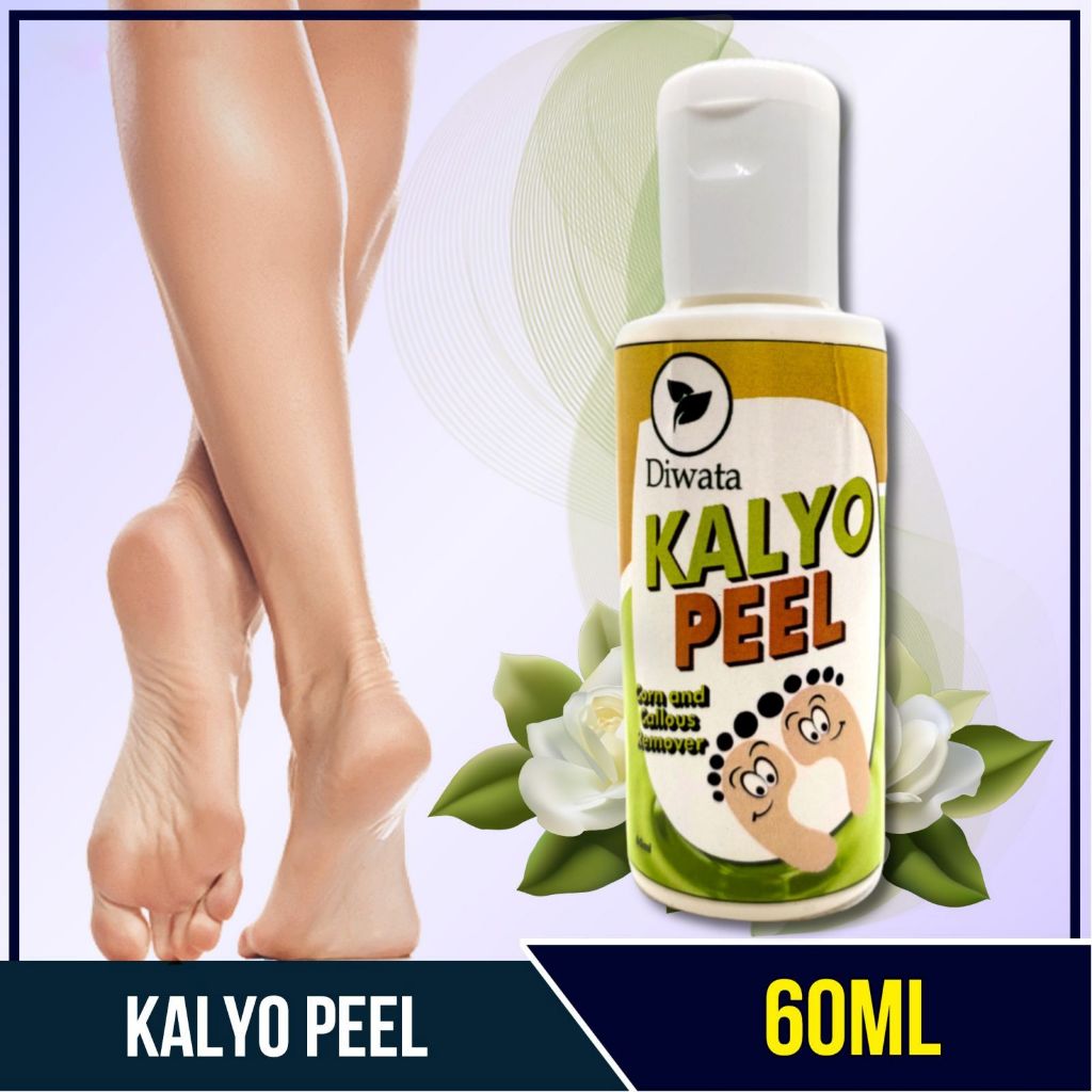 Original Diwata Kalyo Peel (60ml) Corn And Callous Remover Soften And ...