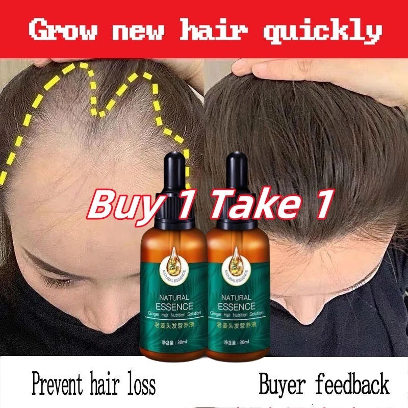 【BUY 1 TAKE 1】Ginger Hair Growth Essential Oil Rapid Hair Growth Serum ...
