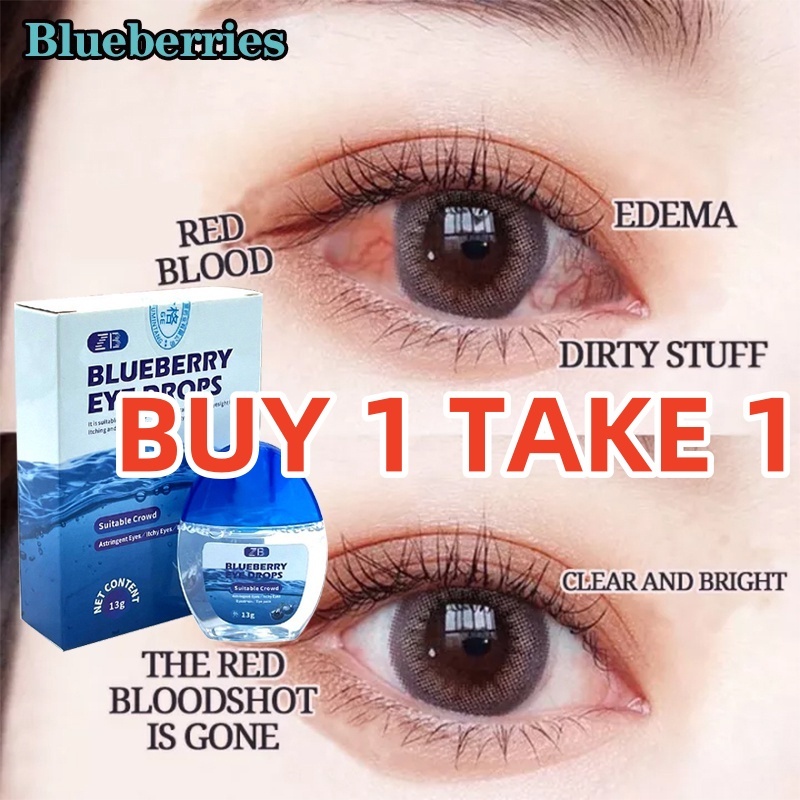 【BUY 1 TAKE 1】COD Blueberry Eye Drops Itchy Eyes Glaucoma Eye Drops ...