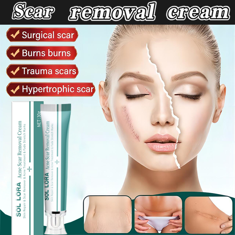 Quick And Effective Scar Remover Cream For Various Scars Repair ...