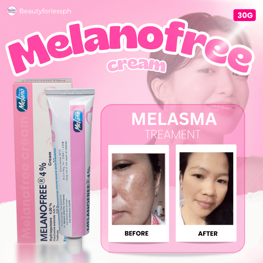 IMB Melanofree Cream for Melasma Whitening Acne scars and freckles 30g ...
