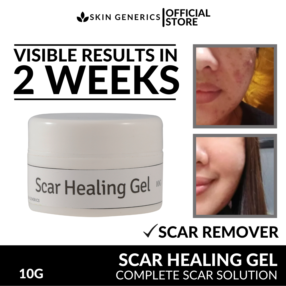 [ SCAR REMOVER + MOISTURIZER ] SkinGenerics Scar Healing Gel for Scars ...