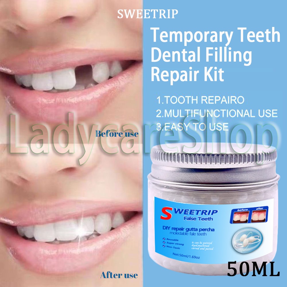 SWEETRIP 50ML Temporary Tooth Repair Teeth Kit Tooth Filling Gaps Solid ...