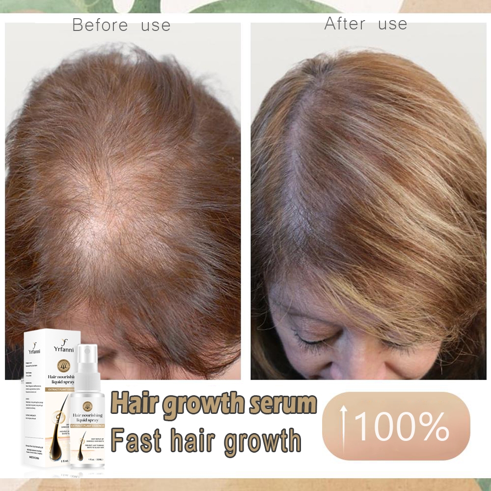 Hair growth serum fast hair growth Hair Grower Hair thickener and ...