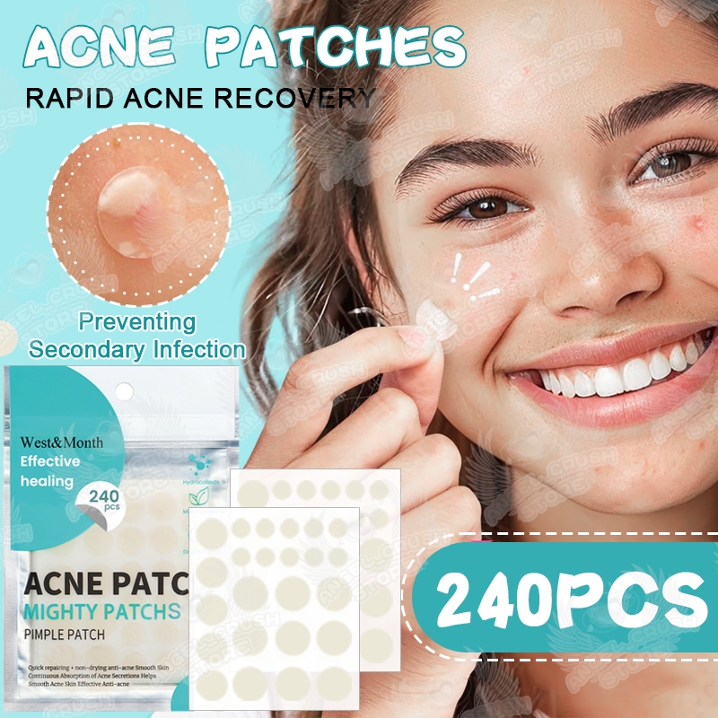 240PCS Pimple Patch Repair Acne Clean Pores Skin Care Waterproof Acne ...