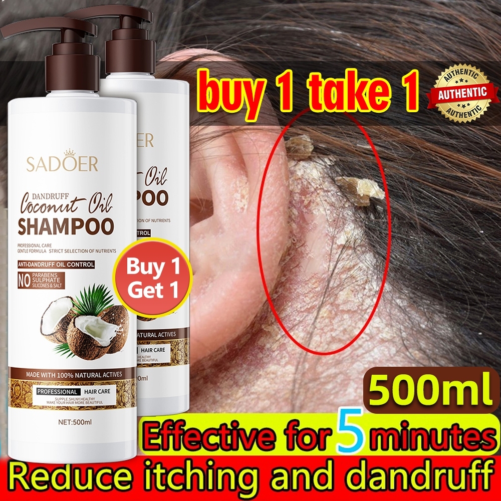 【BUY 1 TAKE 1】Sadoer Coconut Shampoo Anti-Dandruff Refreshing Control Oil Fluffy Repair Frizz ...