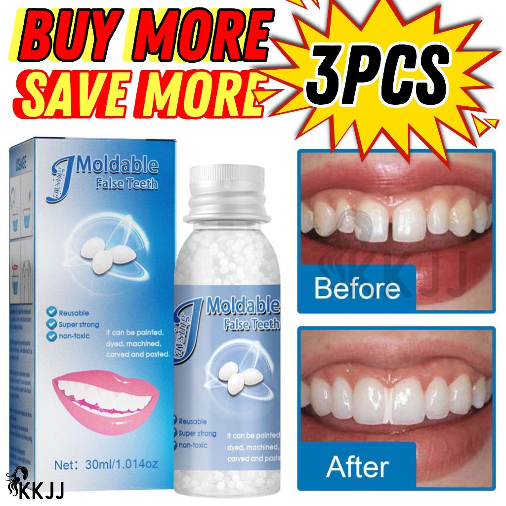 30ML Temporary Tooth Repair Kit Teeth and Gaps Moldable False teeth ...