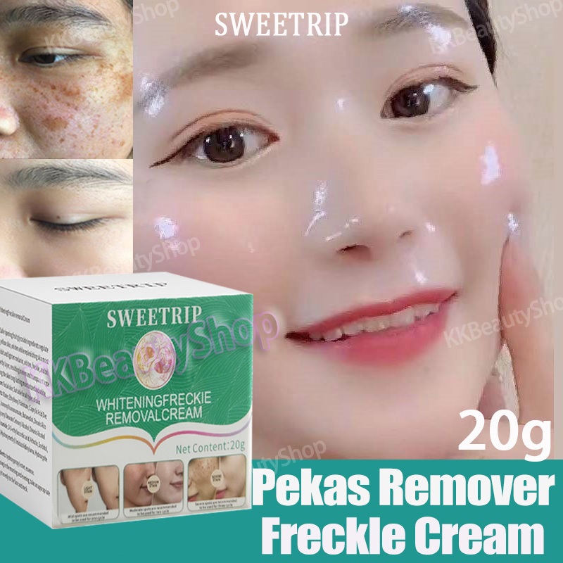 SWEETRIP Pekas Remover Melasma Cream Whitening Freckle Cream Dark Spots ...