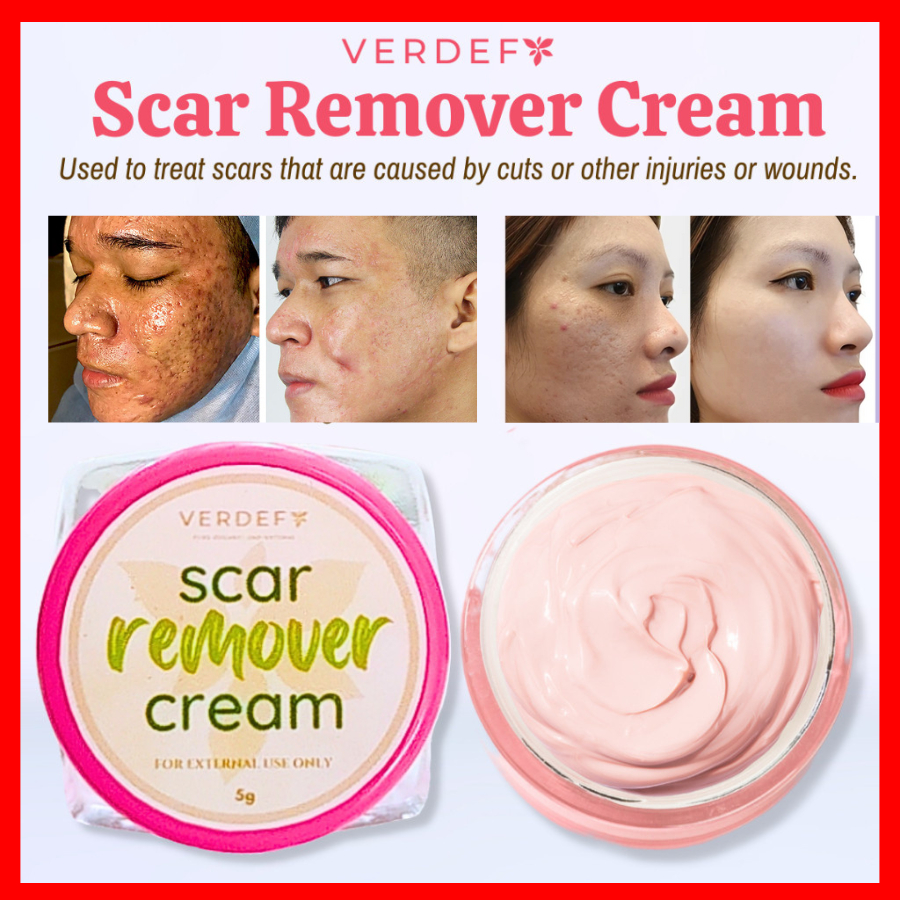 Scar Lightening & Remover Cream by Verdefy PH SCAR REMOVER CREAM SKIN ...