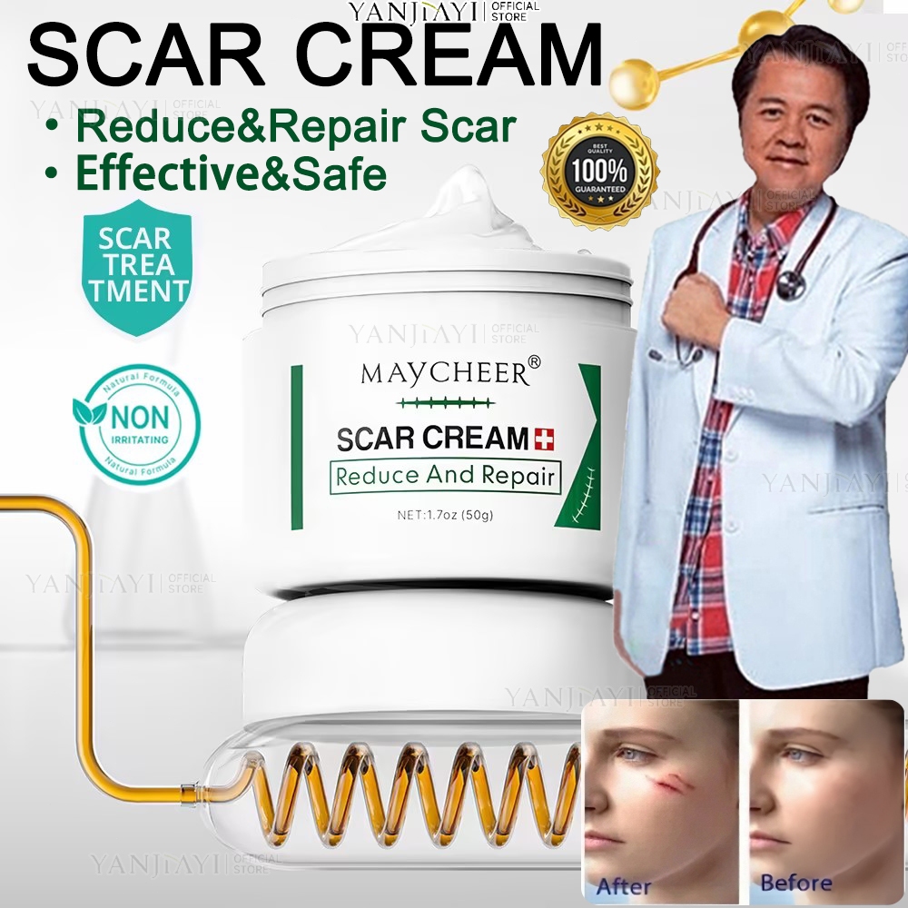 Scar Removal Cream Pantanggal Peklat Body Stretch Mark Remover ...