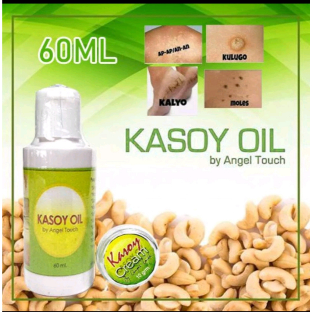 KASOY OIL Pantanggal ng Warts, Nunal, Skin Tag, Kulugo at Kalyo ...