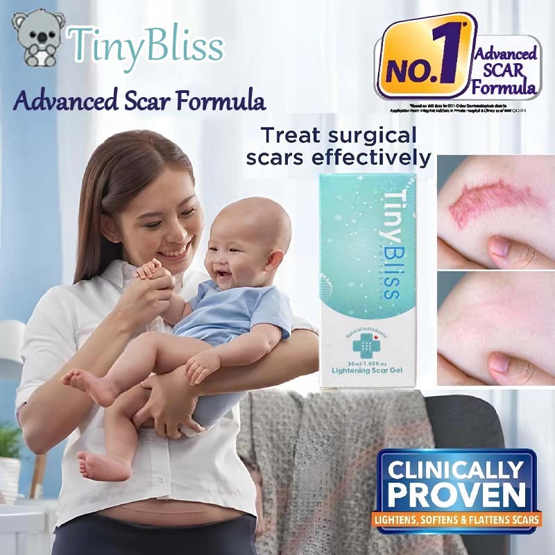 TinyBliss Lightening Scar Gel For Baby Scar Remover For Kids 30ml ...