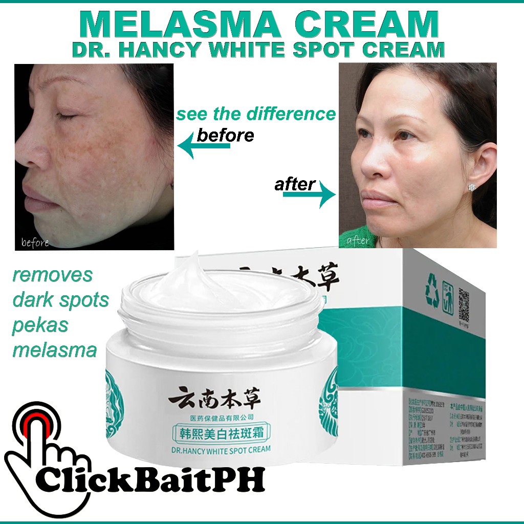 Original Japanese Melasma Cream – Effective Whitening and Moisturizing ...