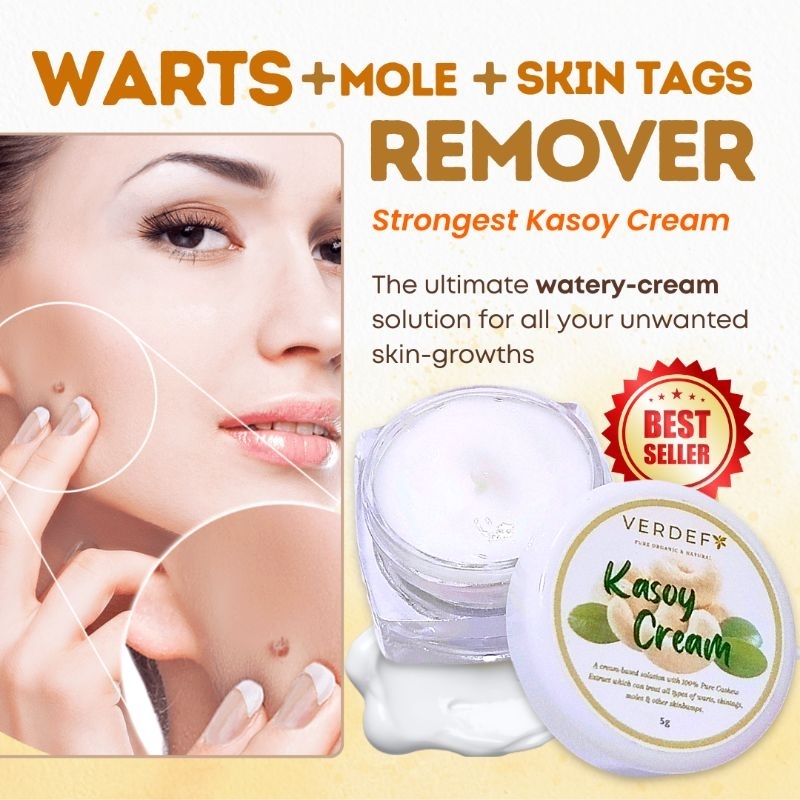 ORIGINAL STRONG KASOY CREAM EFFECTIVE REMOVER OF WARTS MOLE SKIN TAG ...