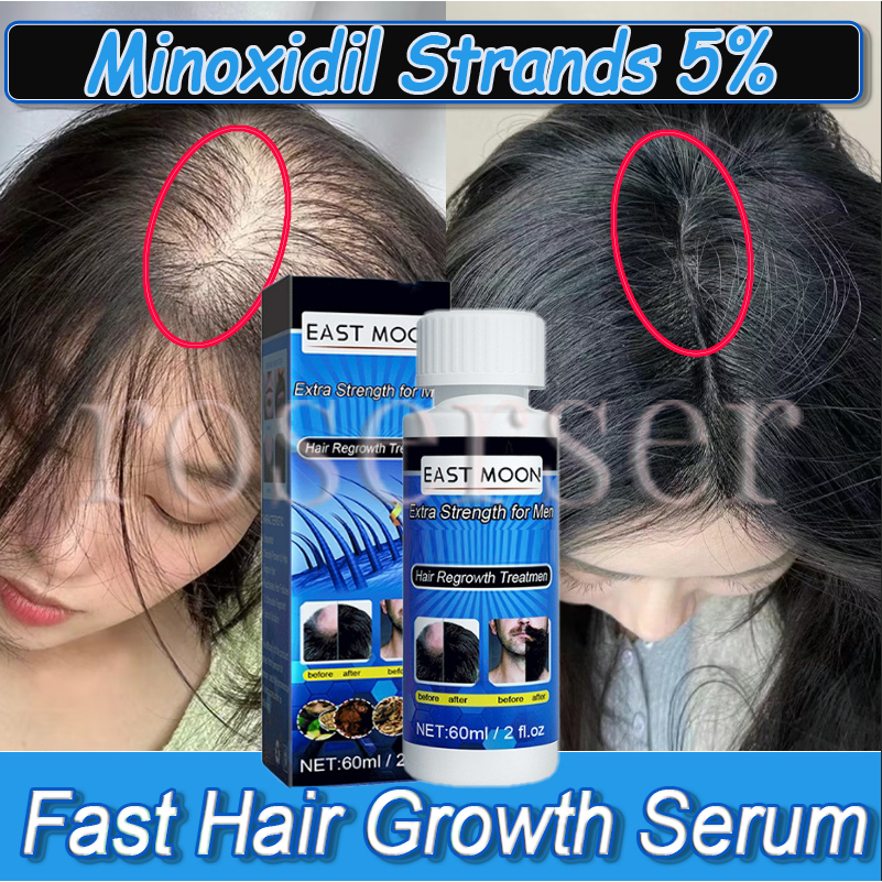 Minoxidil Strands 5% Minoxidil Anti Hair Loss Liquid Promote Thick Fast ...