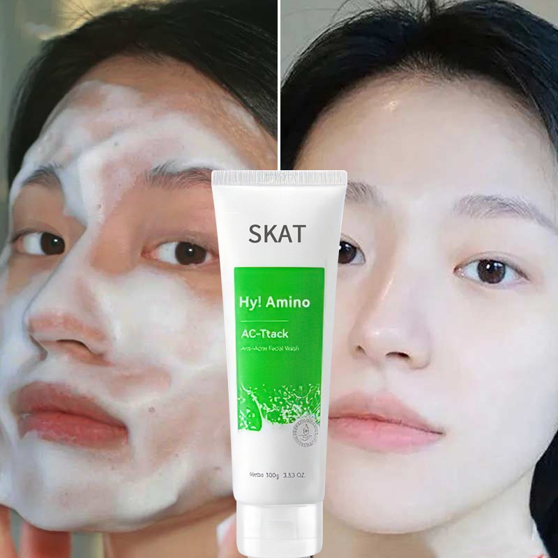 Hy!Amino AC-Ttack Anti-Acne Whitening Facial Wash Salicylic Acid Oil ...
