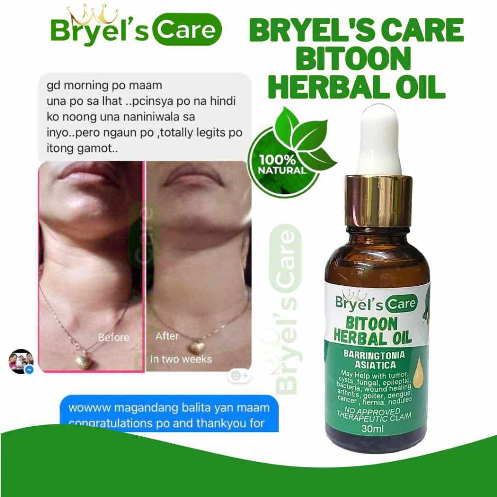 BRYEL'S CARE BITOON HERBAL OIL 30ML NAKAKATULONG PANGTUNAW NG BUKOL BAWAL SA BATA AT SA BUNTIS ...