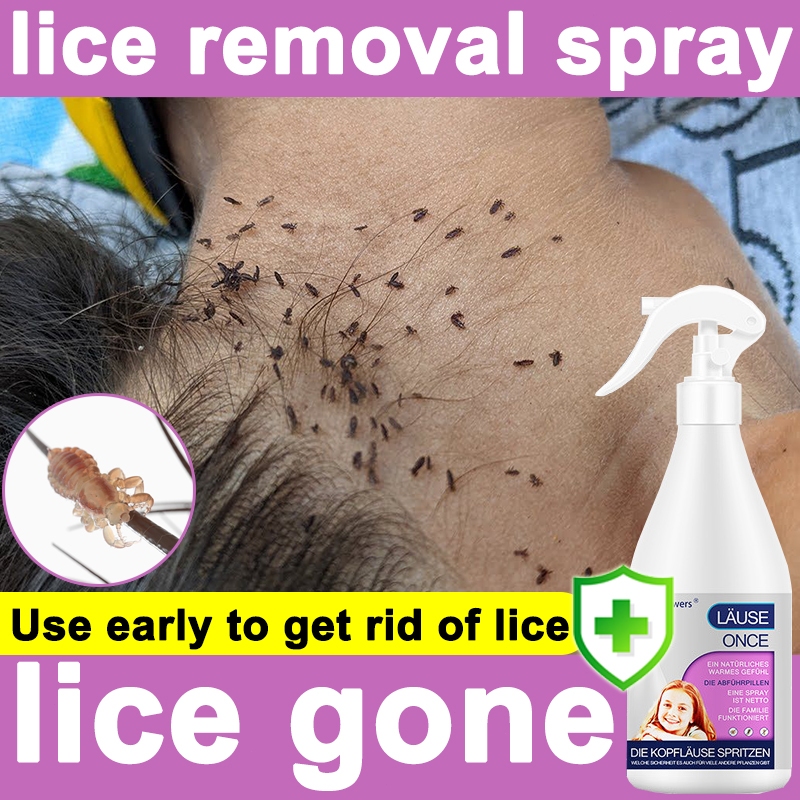 suyod para sa kuto at lisa 200ml harmless to people and pets lice ...
