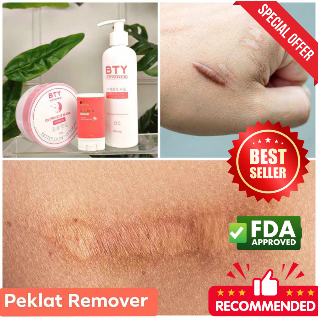 BTY SELF CARE TRIO - BEST SELLER! PEKLAT REMOVER SET | Shopee Philippines