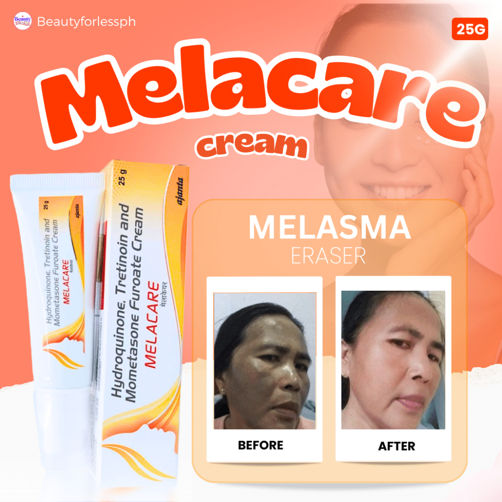 AUTHENTIC MelaCare Pekas remover dark spot pekas eraser melasma eraser ...