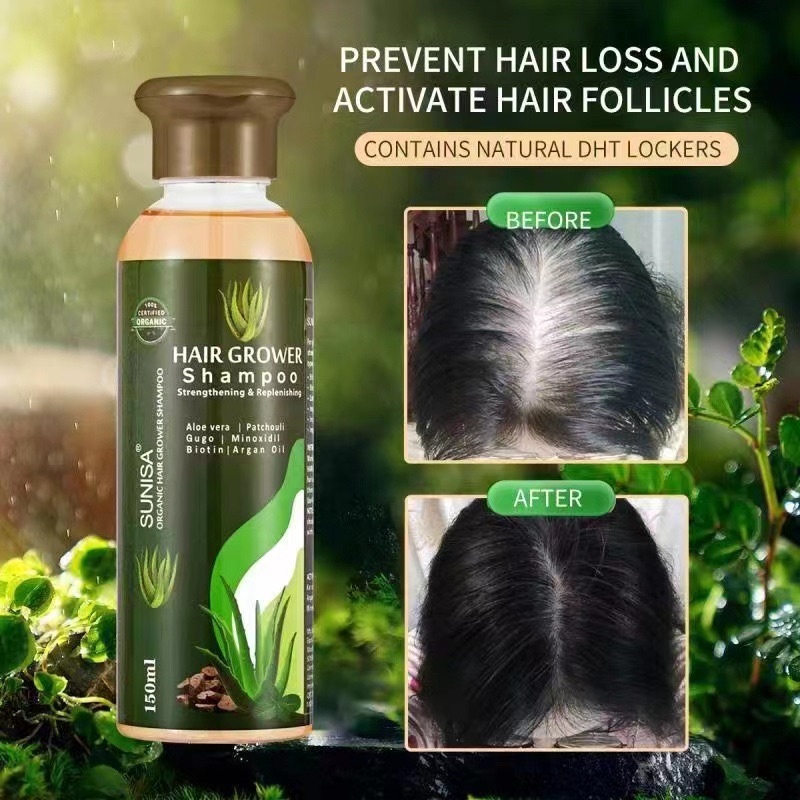 Sunisa Hair Grower Shampoo - Natural DHT Blocker for Healthy ...
