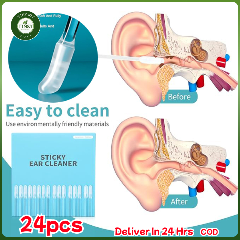 Sticky Ear Sticks Ear Wax Remover Ear Cleaning Adhesive Cleaning ...