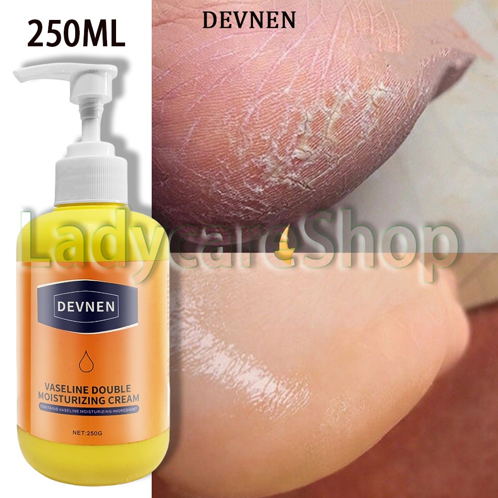Devnen Vaseline Hand Foot Moisturizing Cream Dry Skin Treatment Lotion
