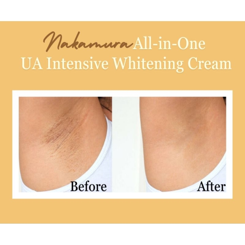 Nakamura All in One UA Intensive Whitening Cream (Nape, Elbow, Knees ...