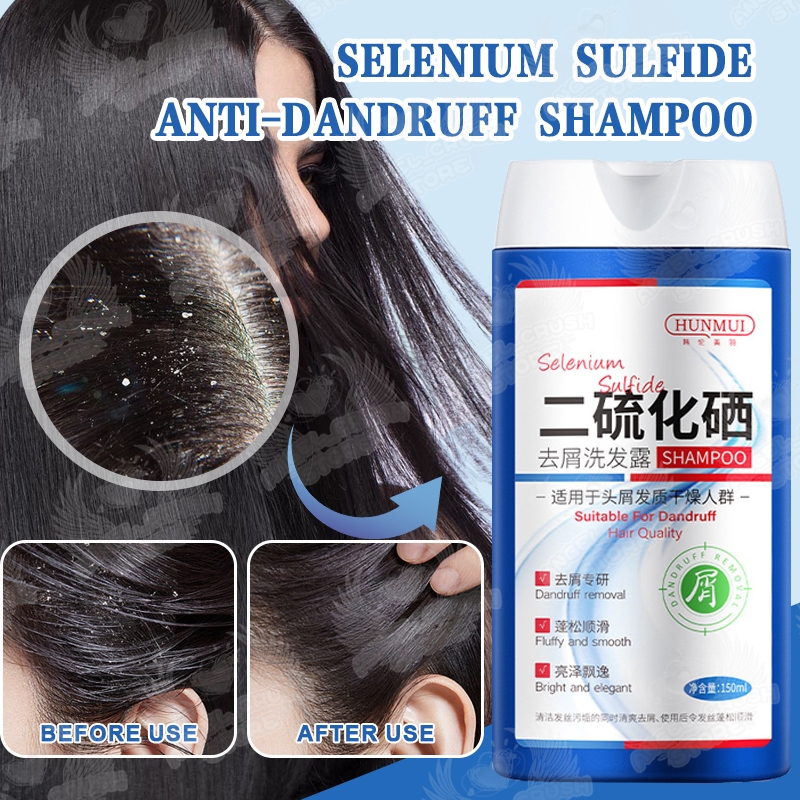 Selenium Sulfide Anti-Dandruff Shampoo Oil Control Anti-Psoriasis Itching Cleansing Scalp ...