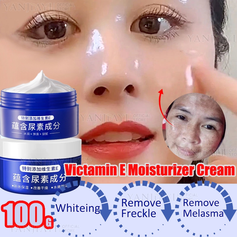 Pekas Cream Remove Melasma Victamin E Moisturizer Whitening Facial Skin ...