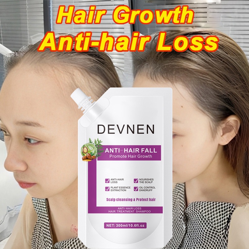 DEVNEN Anti-Hair Loss Shampoo Nourish Hair Fast Growth Grapeseed Oil ...