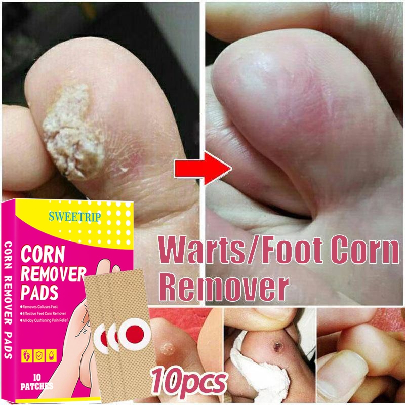 SWEETRIP 10PCS Foot Corns Remover Patch Remove Calluses Pain Relief ...