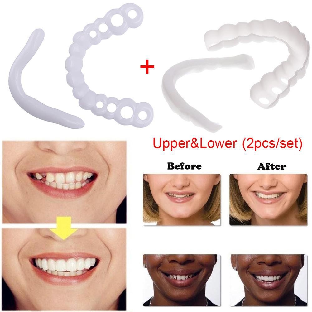 2pcs / Set Perfect Teeth Veneers False Tooth Fake Teeth Instant Perfect ...