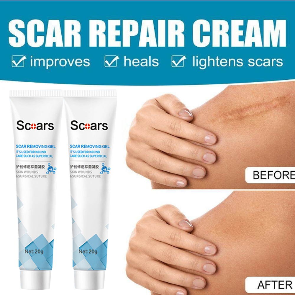 Scar Remover Cream Scar Remover Acne Scar Remover for Face Body Old ...