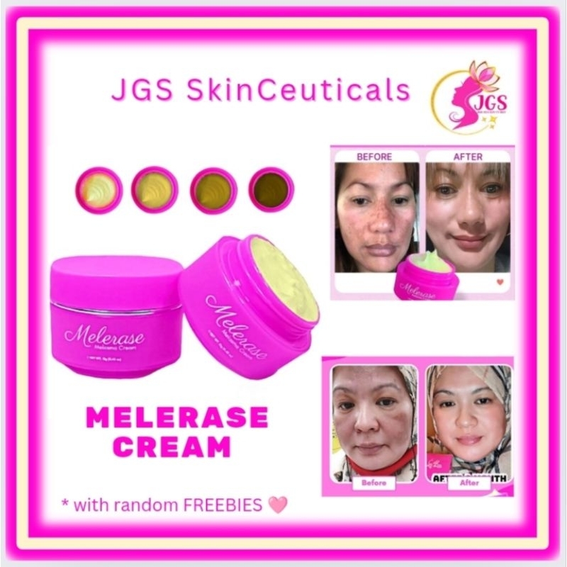 Belle Glow Melerase Cream 12g for Pekas, Melasma, Freckles, Pimple ...