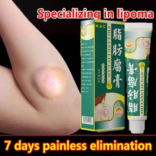 50g Lipoma Removal Cream Original Japan Bukol Treatment Tumor Skin ...